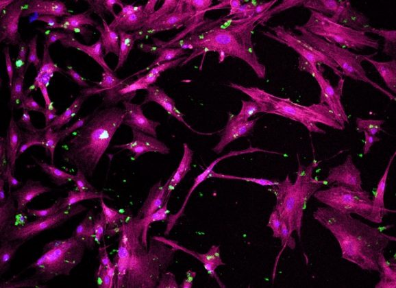 Scientists develop porous nanoparticles for regenerative medicine ...